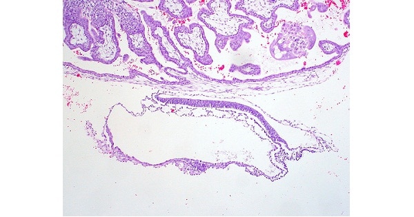 Derivatives Of Mesoderm - New
