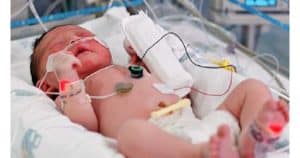 Neonatal Sepsis - New