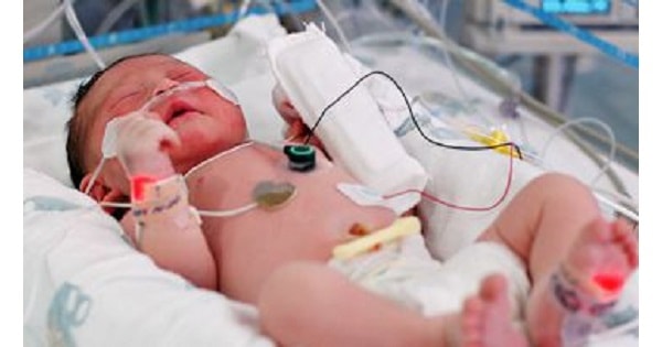 Neonatal Sepsis - New
