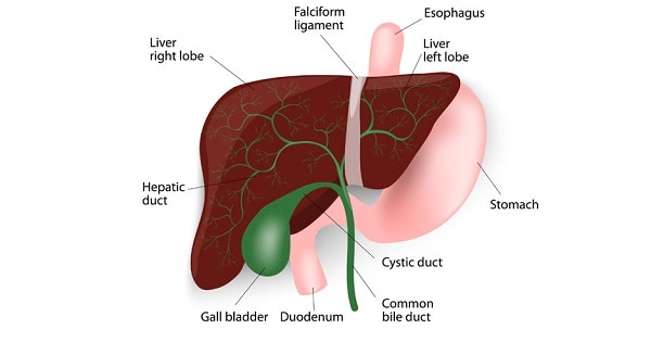 Choledochal Cyst - New