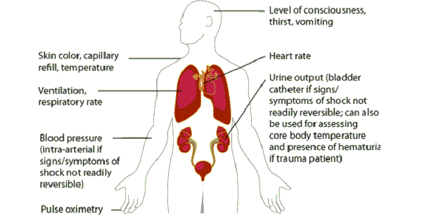 Hypovolemic Shock - www.medicoapps.org