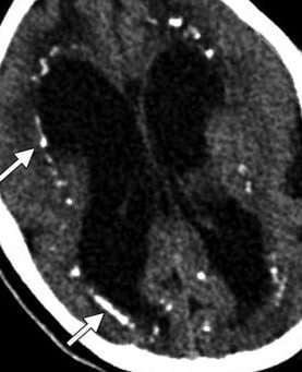 Image Based Question-64980 - New