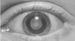 Image Based Question-65978 - New