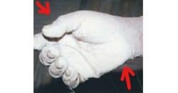 Drowning-Autopsy findings - New