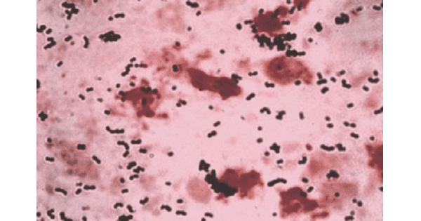 Hemolytic Streptococci- Group A, B, C, D and F - New