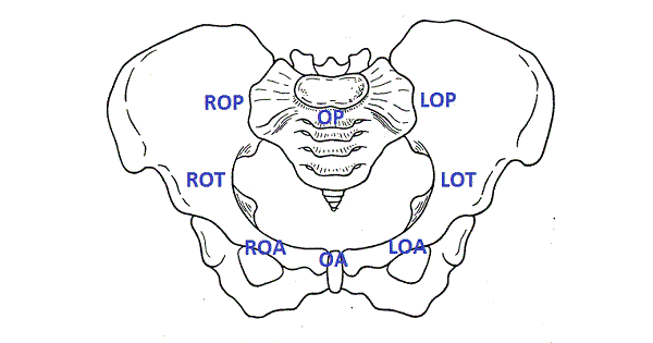 Occiput-Posterior Position (OP) - www.medicoapps.org