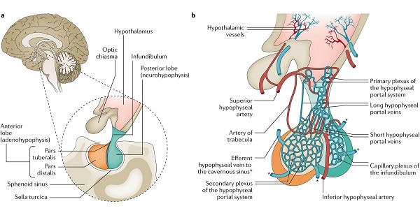 Sheehan's syndrome - New