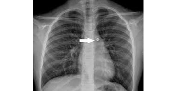 Image Based Question-65533 - New