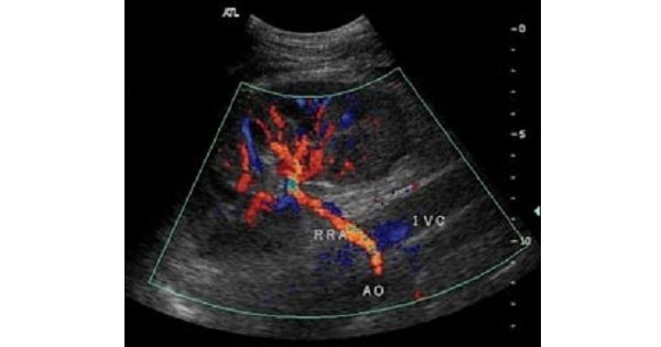 Image Based Question-67066 - New