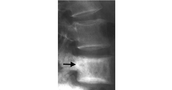 Image Based Question-72062 - New