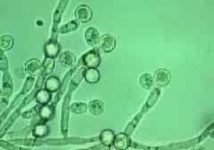 Candida: Diagnosis and Treatment - New
