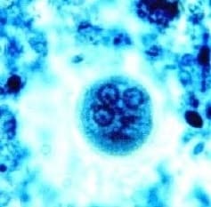 Entamoeba histolytica - New