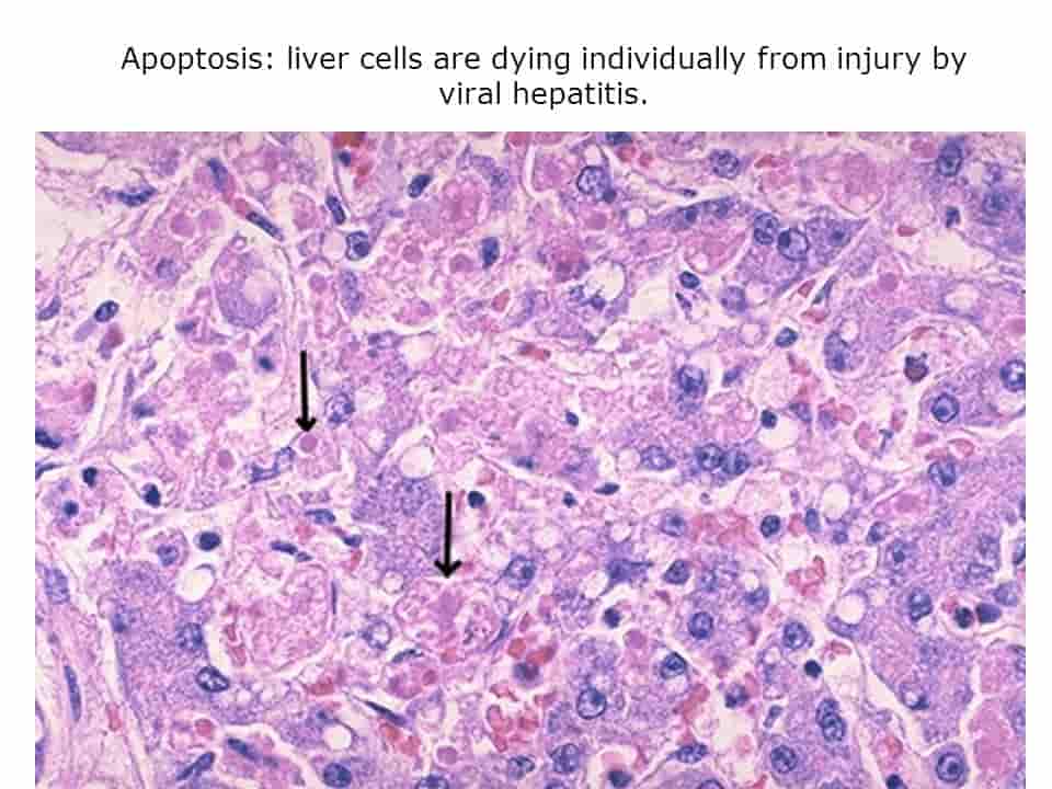 APOPTOSIS - www.medicoapps.org