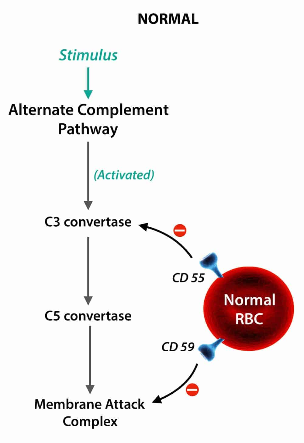 PAROXYSMAL NOCTURNAL HEMOGLOBINURIA (PNH) - New