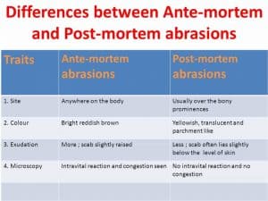 Differences+between+Ante-mortem+and+Post-mortem+abrasions - New