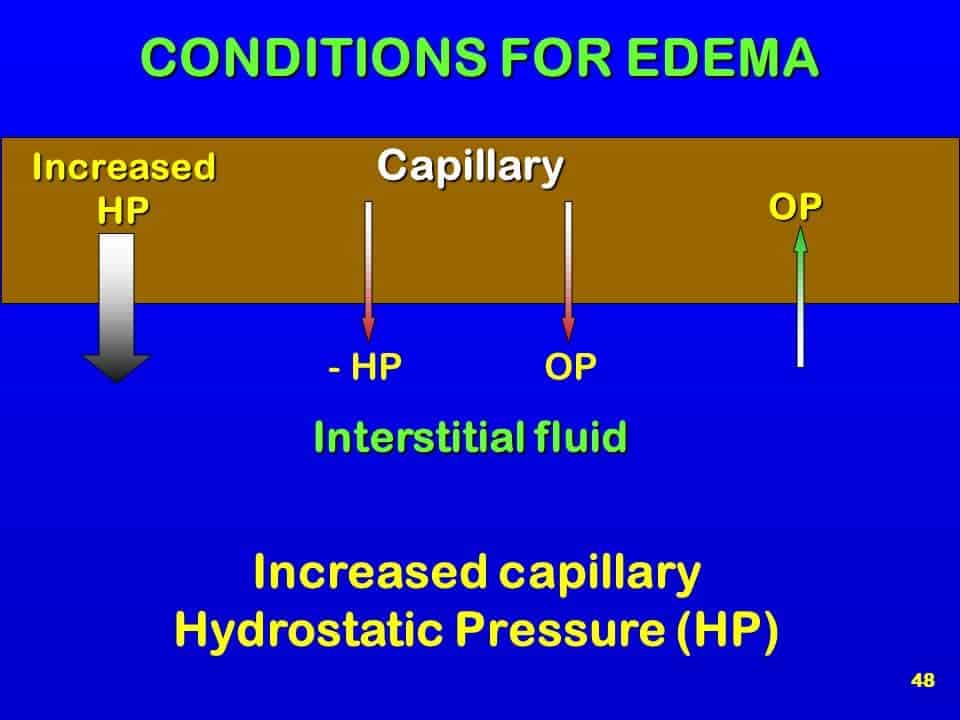 Edema- basics - New