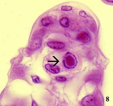 Varicella Zoster - www.medicoapps.org