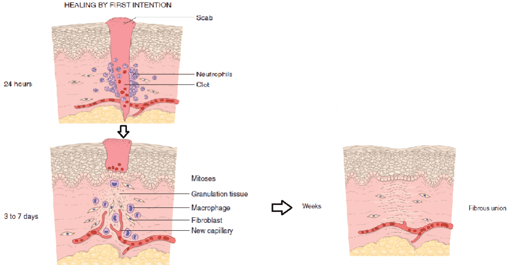 first intention - New