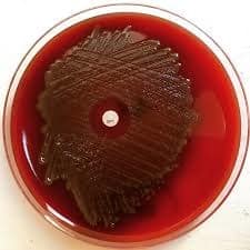 Streptococcus Pneumonia - New