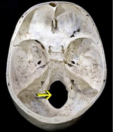 FORAMENS OF SKULL - www.medicoapps.org