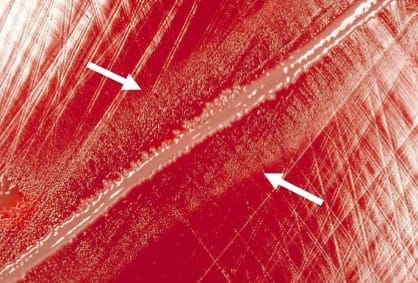 Haemophilus influenzae - New