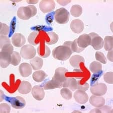 Plasmodium: Diagnosis - New