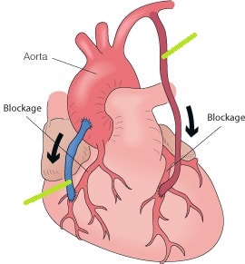 med_1493917463_1 - New