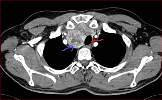 med_1494144767_1 - New