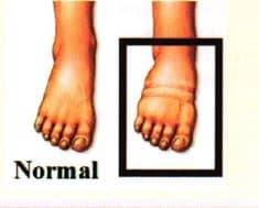 Image Based Question-67811 - New