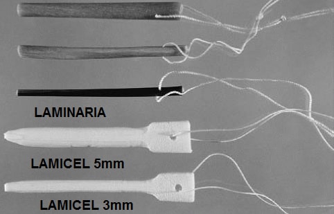 Cervical Ripening & INDUCTION OF LABOUR - www.medicoapps.org