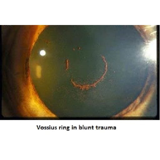 med_1528889116_1 - New