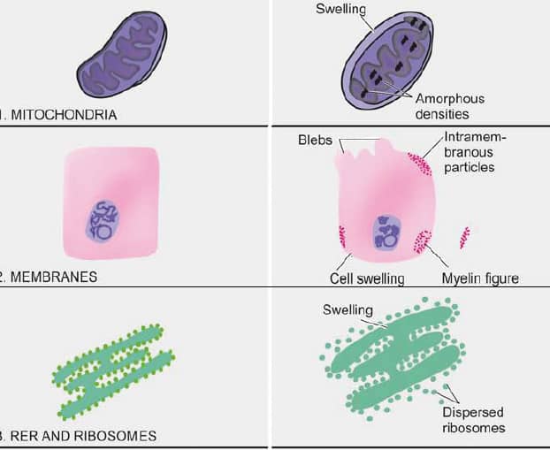 Reversible cell injury - www.medicoapps.org