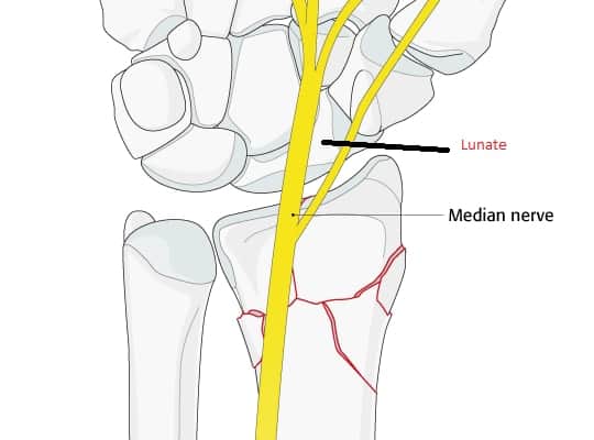 BONES OF HAND- CARPAL - New