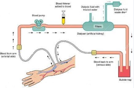 Hemodialysis and Hemoperfusion - www.medicoapps.org