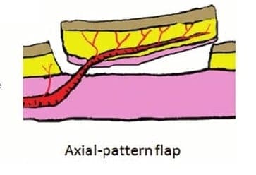 FLAPS - www.medicoapps.org