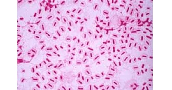 Haemophilus influenzae Archives - www.medicoapps.org