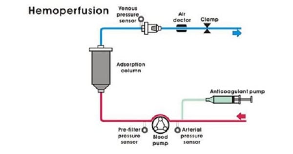 Hemodialysis and Hemoperfusion - www.medicoapps.org