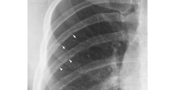 AIIMS PG Archives - Page 176 of 784 - www.medicoapps.org