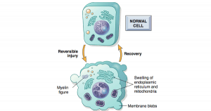 Reversible cell injury - New