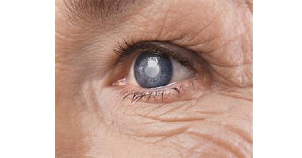 Vision & Visual Symptoms - New