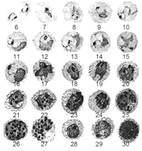 med_plasmodium_malariae - New