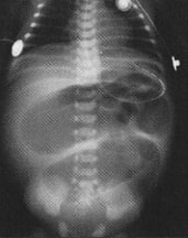 med_usg_abdomen - New