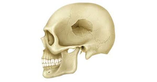 Antemortem VS Postmortem Wound - www.medicoapps.org