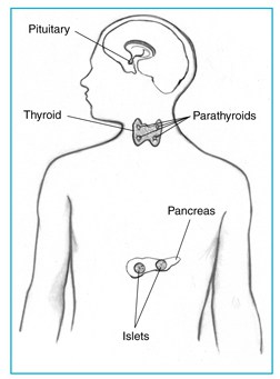 Multiple Endocrine Neoplasia (Men) - New