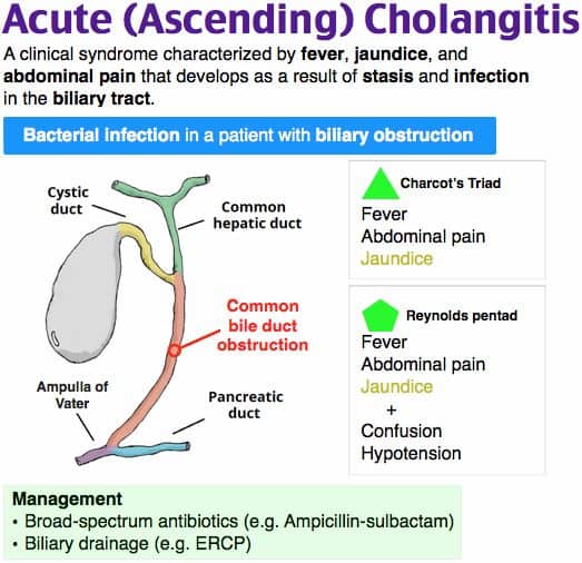 acute cholangitis - New