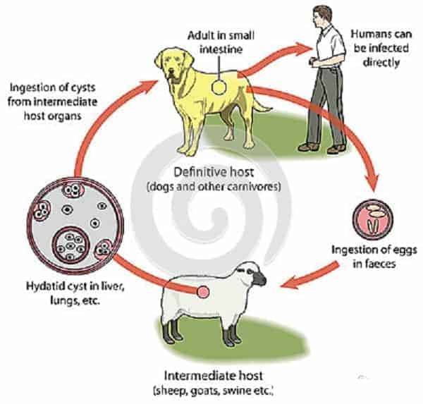 HYDATID CYST OF LIVER - www.medicoapps.org