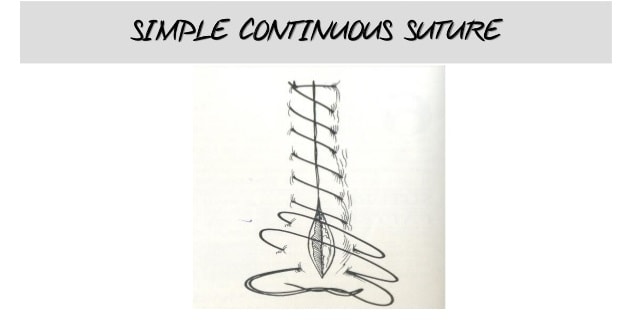 simple continous suturing - New