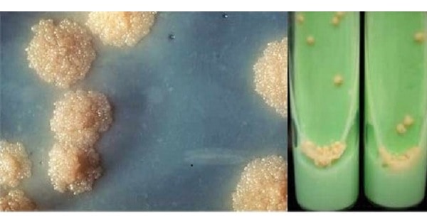 Löffler's medium Archives - www.medicoapps.org