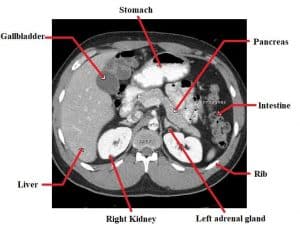 Normal abdominal CT - New