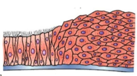 NEET PG - 84238 - New